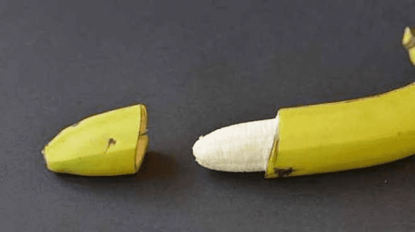 Plus Minus Metode Sunat Dari di Laser Hingga di Stapler - Klinik Semper